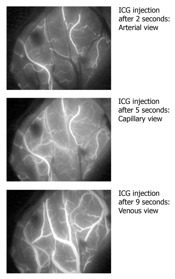 FL800 外科手术显微镜 - 媒体 | 产品 | 徕卡显微系统