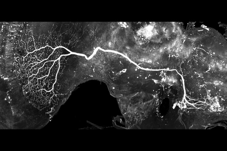 检查癌症类器官的发展进程 | 显微镜知识库 | 徕卡显微系统