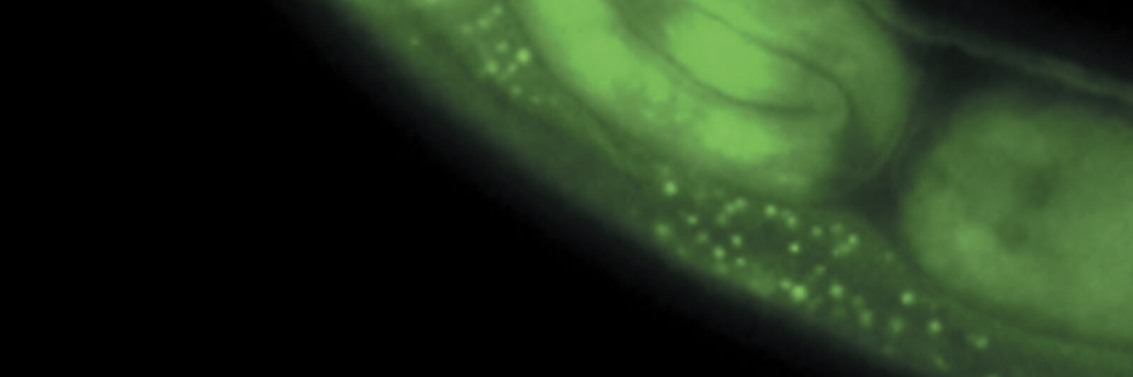 Leica DM2000 & DM2000 LED 生物显微镜 | 医疗正置显微镜 | 产品 | 徕卡显微系统