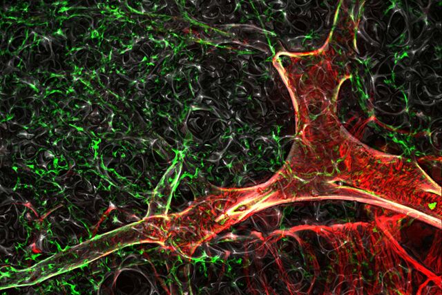 Leica LMD6 & LMD7 激光显微切割系统 | 产品 | 徕卡显微系统