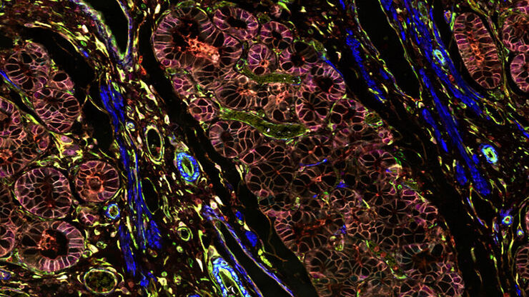 Leica LMD6 & LMD7 激光显微切割系统 - 应用 | 产品 | 徕卡显微系统