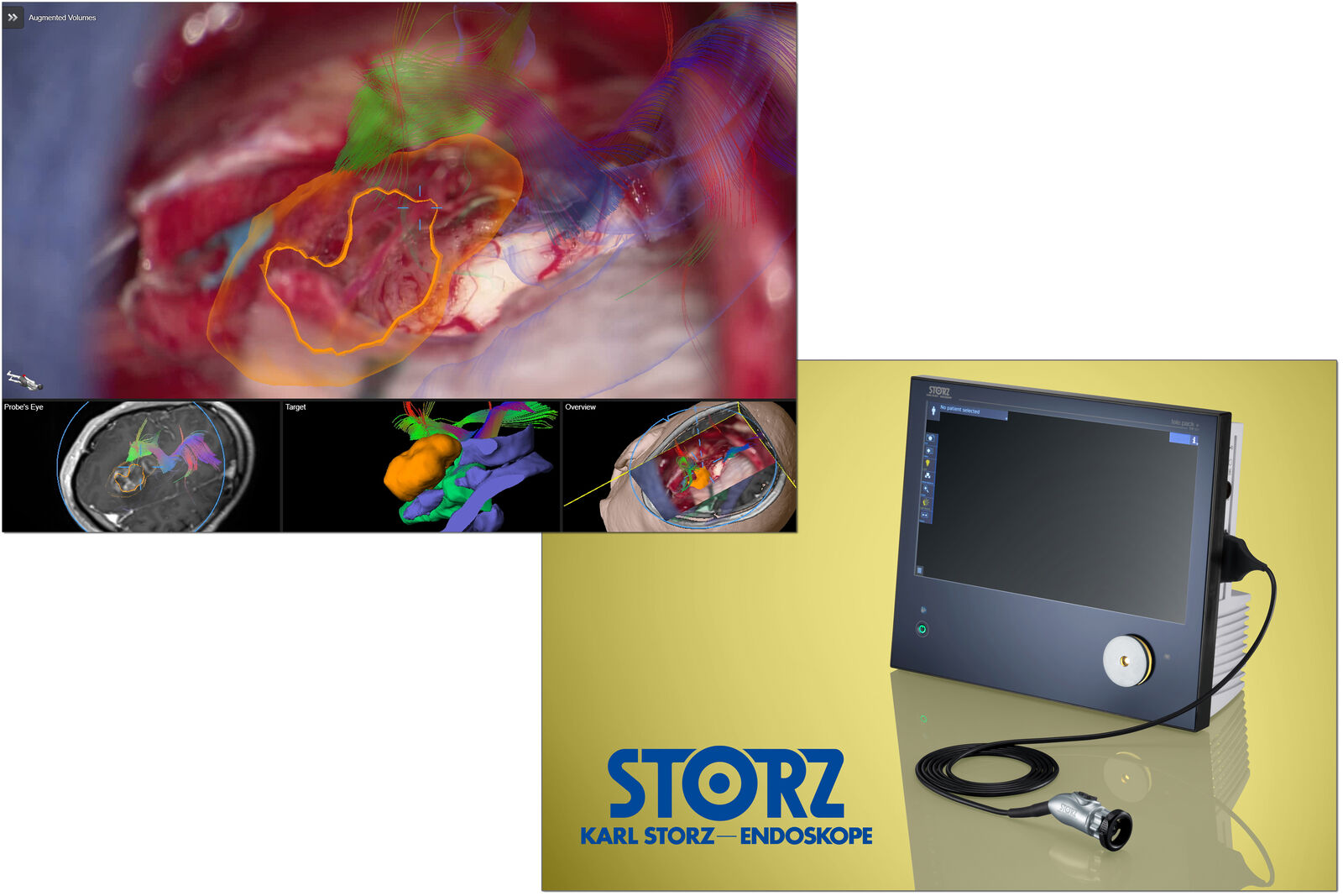 ARveo 8 徕卡Arveo 8手术显微镜 - 创新设计，提供全方位手术视野 | 产品 | 徕卡显微系统