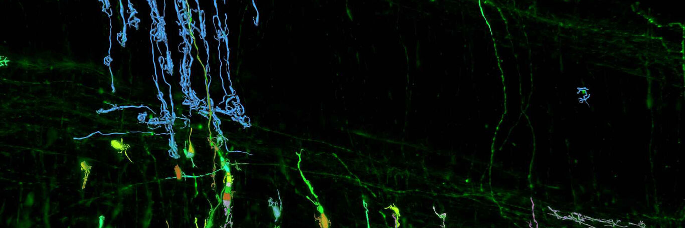 Aivia AI图像分析软件 | 产品 | 徕卡显微系统