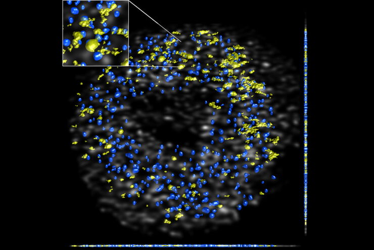 STELLARIS平台上的STED 显微镜 - 应用 | 产品 | 徕卡显微系统
