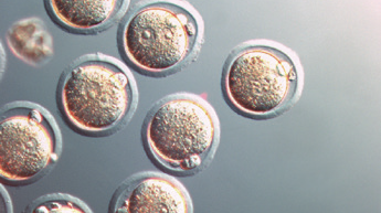 DMi8 S 高速成像平台 倒置显微镜成像解决方案 | 产品 | 徕卡显微系统