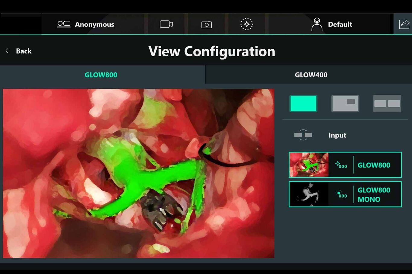 ARveo 8 徕卡Arveo 8手术显微镜 - 创新设计，提供全方位手术视野 | 产品 | 徕卡显微系统
