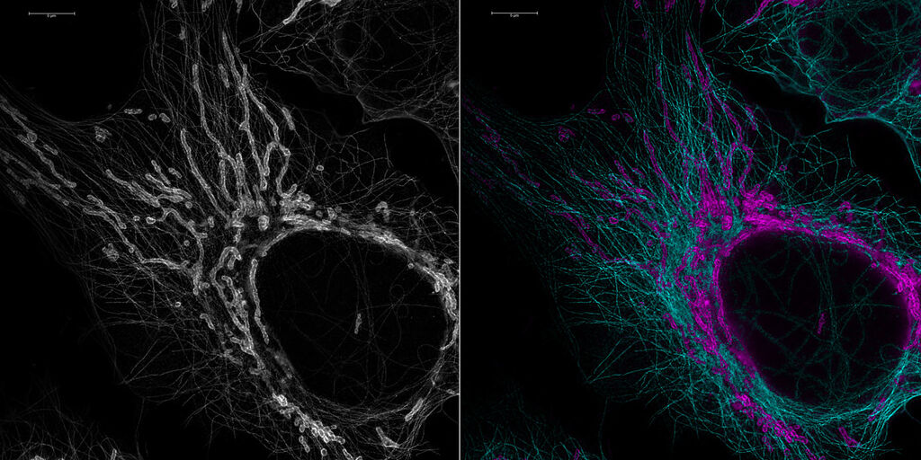 STELLARIS平台上的STED 显微镜 | 产品 | 徕卡显微系统