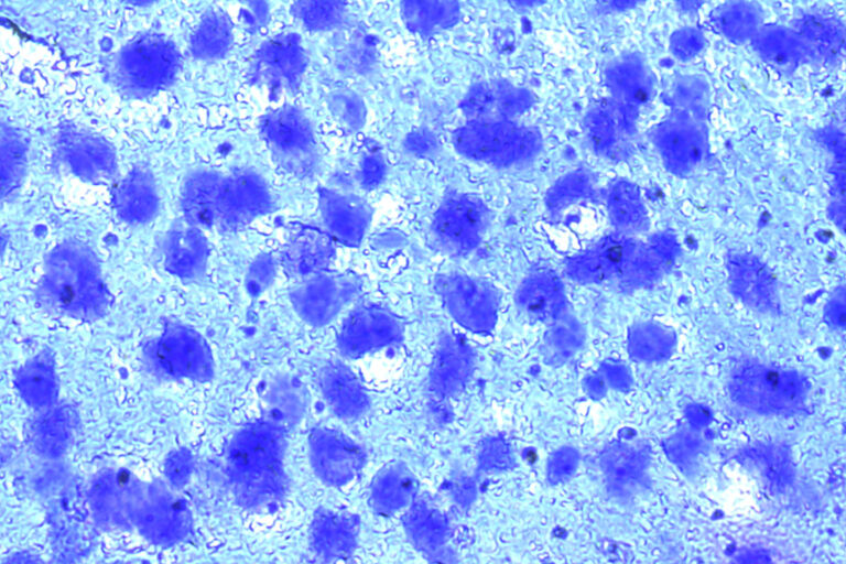 Leica LMD6 & LMD7 激光显微切割系统 | 产品 | 徕卡显微系统