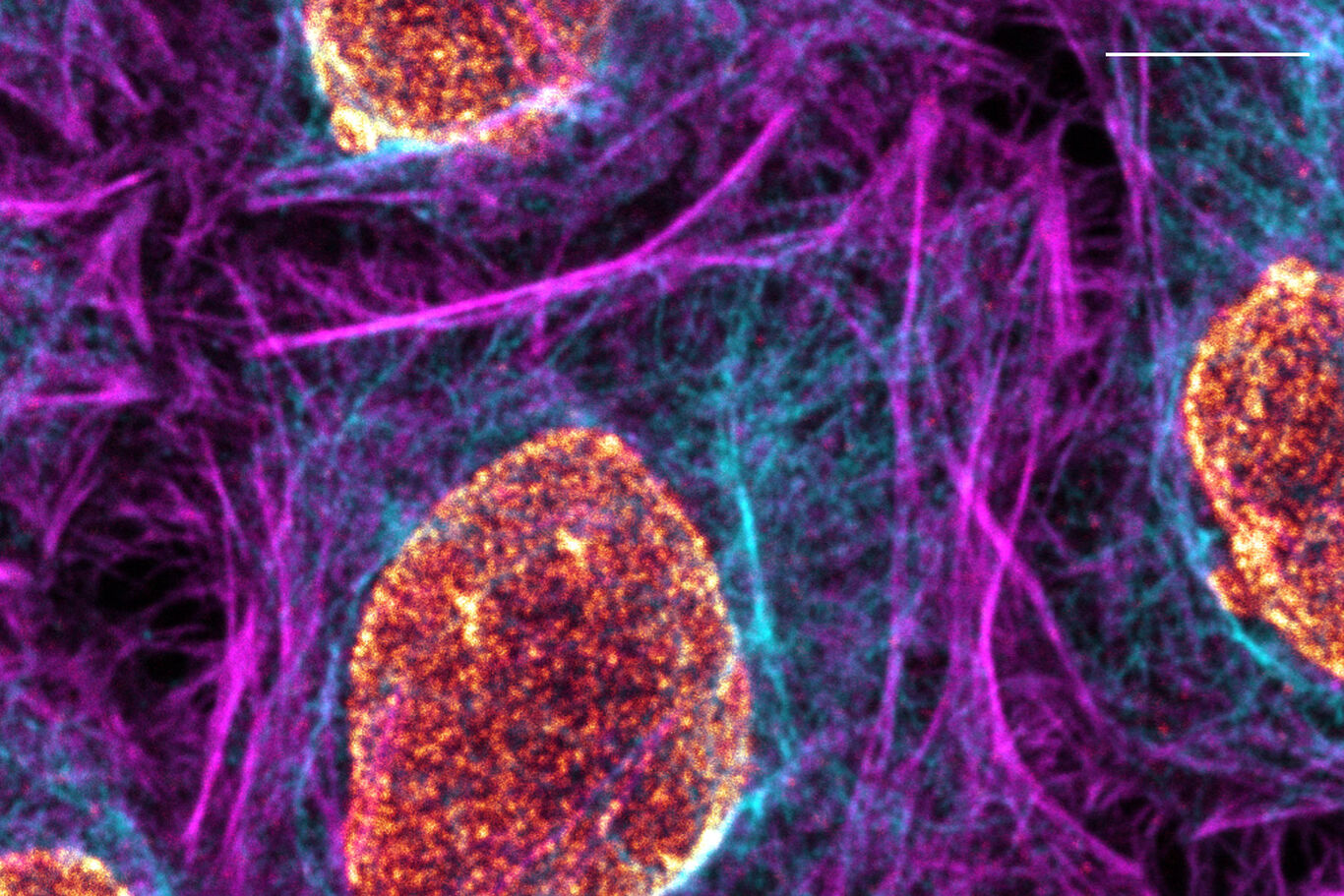 STELLARIS平台上的STED 显微镜 | 产品 | 徕卡显微系统