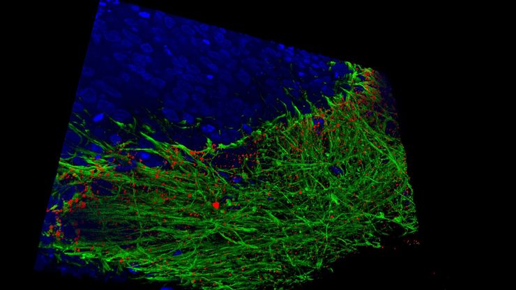 从光到思维：共聚焦显微镜中的检测器和测量技术 | 学习与分享 | 徕卡显微系统