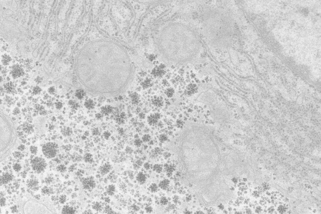 探索 TEM 超薄切片自动染色的替代方案 | 学习与分享 | 徕卡显微系统