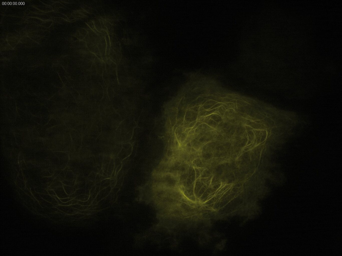 全内反射荧光显微镜（total internal reflection fluorescent microscope，TIRFM）在生命科学 ...