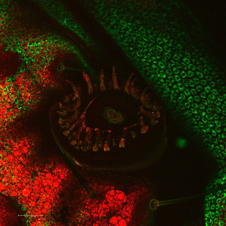 CARS 相干反斯托克斯拉曼散射显微镜简介 | 学习与分享 | 徕卡显微系统