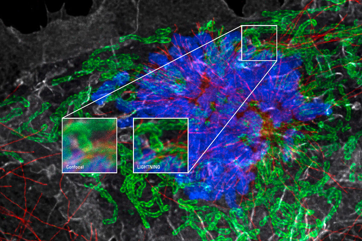 使用 LIGHTNING 可从样本中获得丰富的信息 | 学习与分享 | 徕卡显微系统