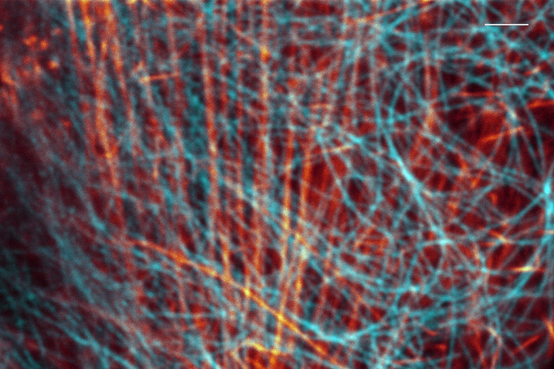 STELLARIS平台上的STED 显微镜 | 产品 | 徕卡显微系统